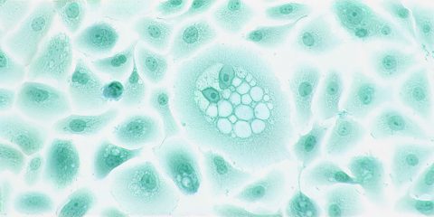 What is Upstream and Downstream bioprocess? - TECNIC