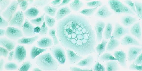 What is Upstream and Downstream bioprocess? - TECNIC